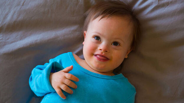 ഡൗൺ സിൻഡ്രോമിന് കാരണം അമ്മയുടെ പ്രായം; ജനിക്കുന്ന കുഞ്ഞിന് ജനിതക പ്രശ് ...